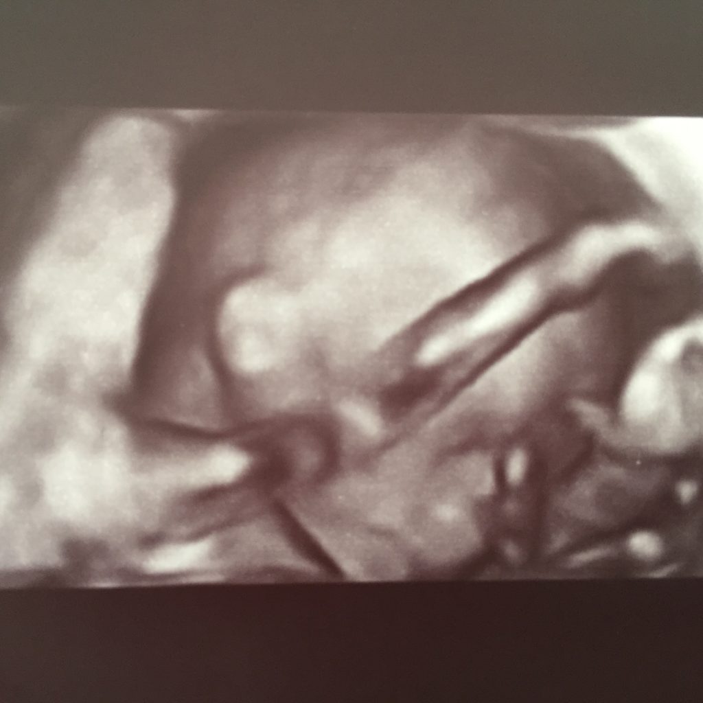 Schwangerschaftstagebuch: 19. und 20. SSW - LÄCHELN UND WINKEN